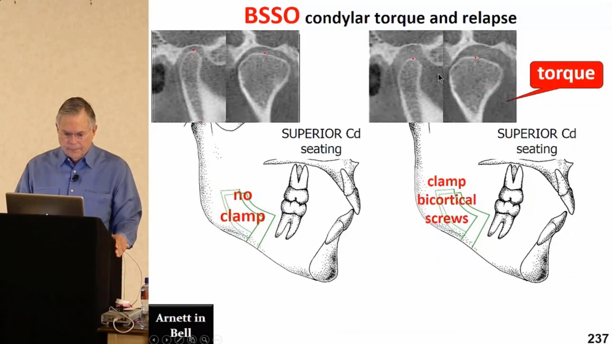 COMPLETE ORTHODONTIC AND ORTHOGNATHIC SURGERY COURSE - COURSE SUMMARY ...